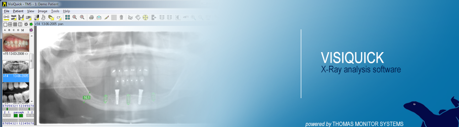 carrousel banner 1 EN – Citodent Imaging B.V. – makers of VisiQuick