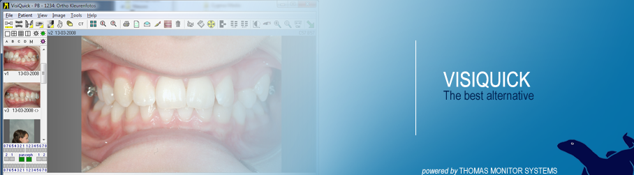 carrousel banner 4 EN – Citodent Imaging B.V. – makers of VisiQuick